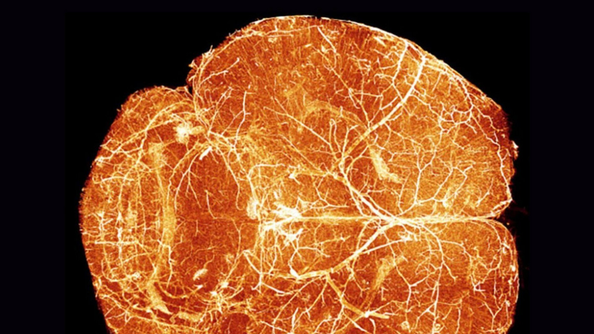 Putting brain development on the map - UdeMnouvelles